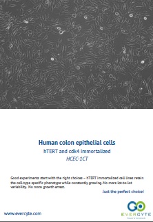 Human colon epithelial cells - hTERT and cdk4 immortalized HCEC-1CT
