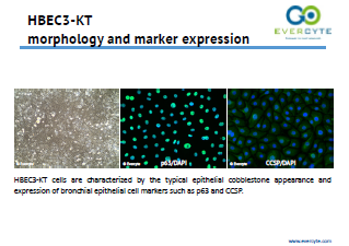 HBEC3-KT morphology and marker expression | Pharmaceutical Networking