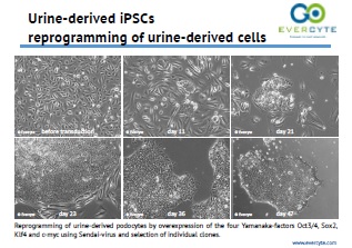 Urine derived iPSCs - reprogramming of urine derived cells ...