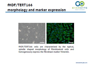 fHDF/TERT166 morphology and marker expression