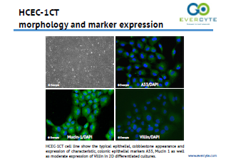 HCEC-1CT - morphology and marker expression | Pharmaceutical Networking