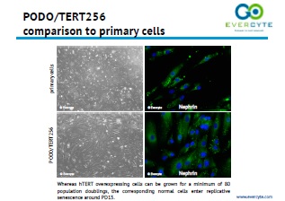 PODO/TERT256 - Comparison to primary cells