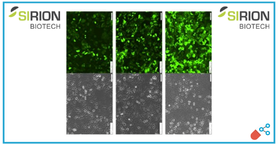 NIAID allergy institute chooses SIRION LentiBOOST™ technology to ...