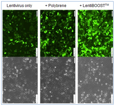 SIRION LentiBOOST™ non-cytotoxic transduction enhancer for lentiviral ...