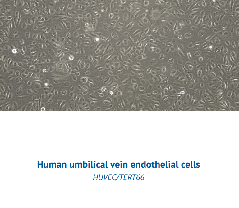 Human umbilical vein endothelial cells - HUVEC/TERT66