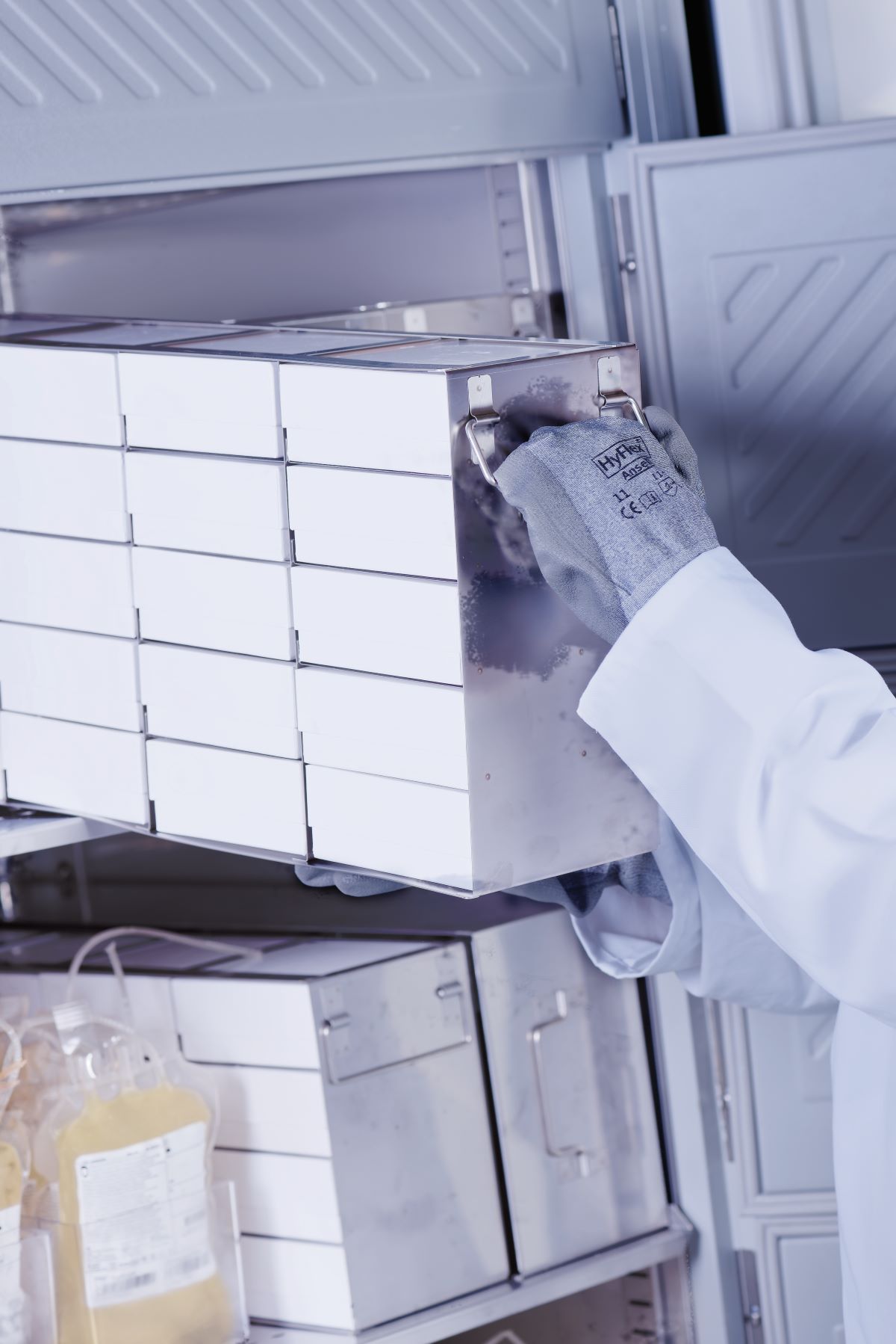 Stability of Cancer Biomarkers Under Ultra-Low Temperature Storage