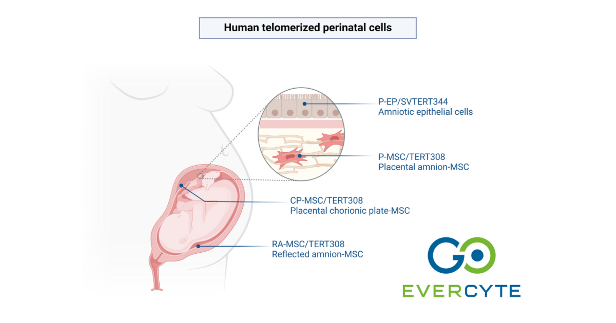Evercyte adds telomerized perinatal cells to immortalized range